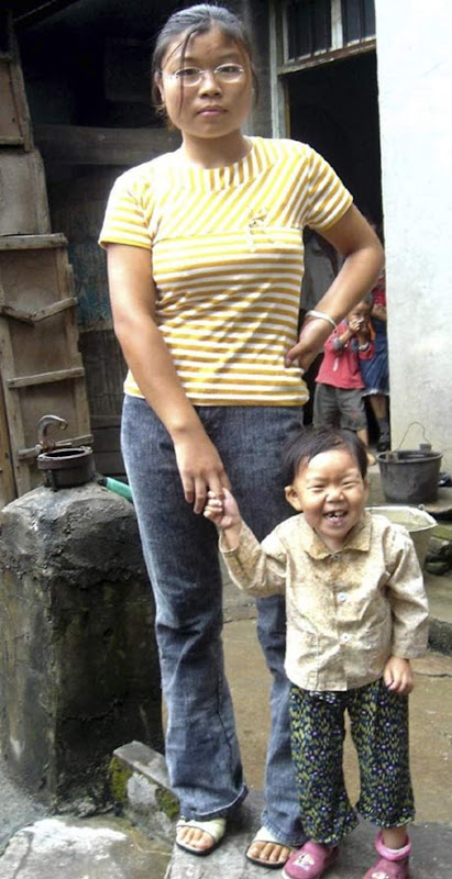 Most Amazing Photos from the World Cultures: 20 Most Extreme Female Bodies